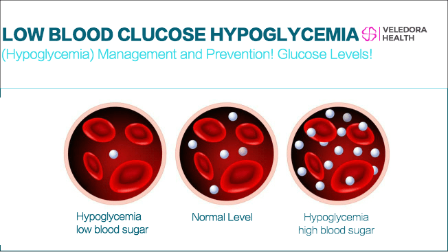 Low Blood Glucose (Hypoglycemia) Management & Prevention!